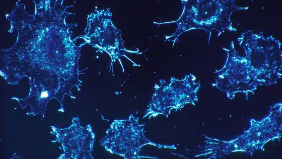 Skąd się bierze rak? Najczęstsze przyczyny i wczesne objawy | Pikio