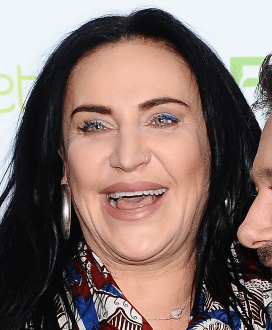 Zaniepokojeni fani pytają: Co się stało z twarzą Kayah?